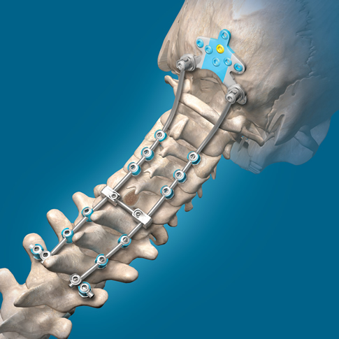 Spinal Products - KT Medical