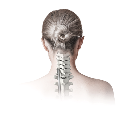 Spinal Products - KT Medical